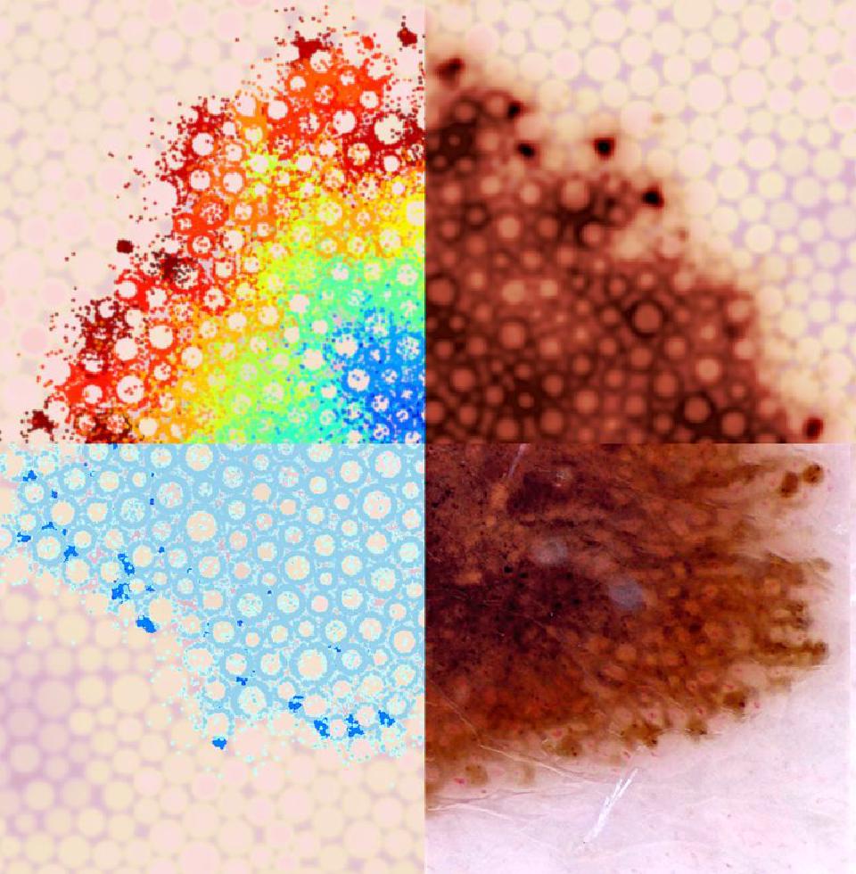 PLOS Computational Biology Accepts Paper on Simulation of Cell-Growth ...